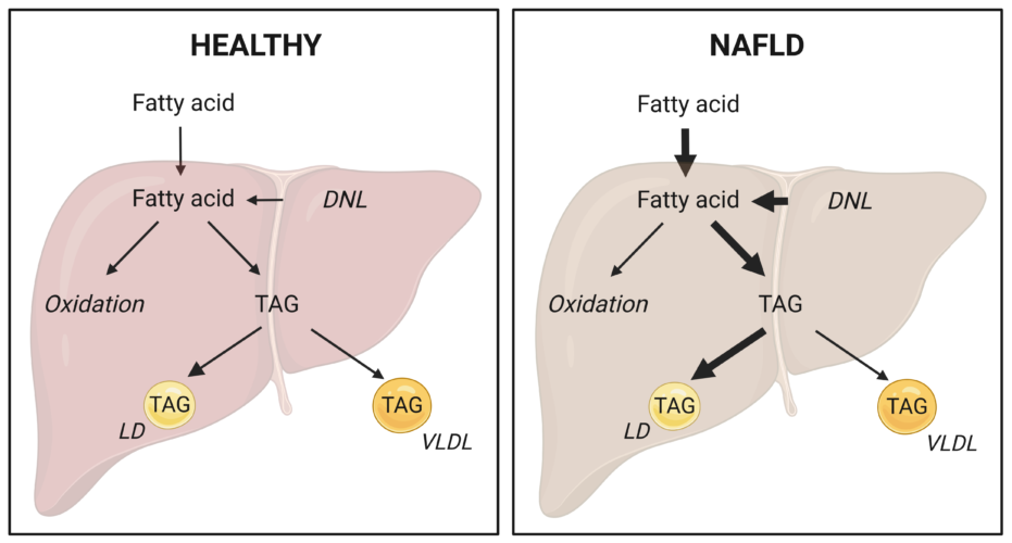 Research | The Lipid Lab